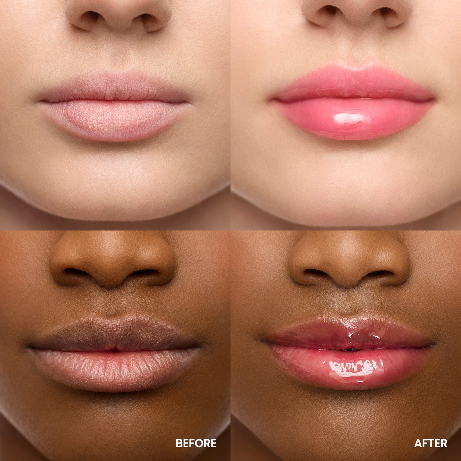 Lip Rehab Serum Oil – WONDERSKIN
